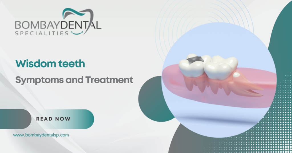Wisdom Tooth Symptoms and Treatment | Bombay Dental Specialities